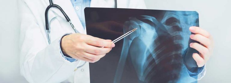 SLAP Lesion, Labral Tear — Shoulder Specialist Dr. Mark Schurz